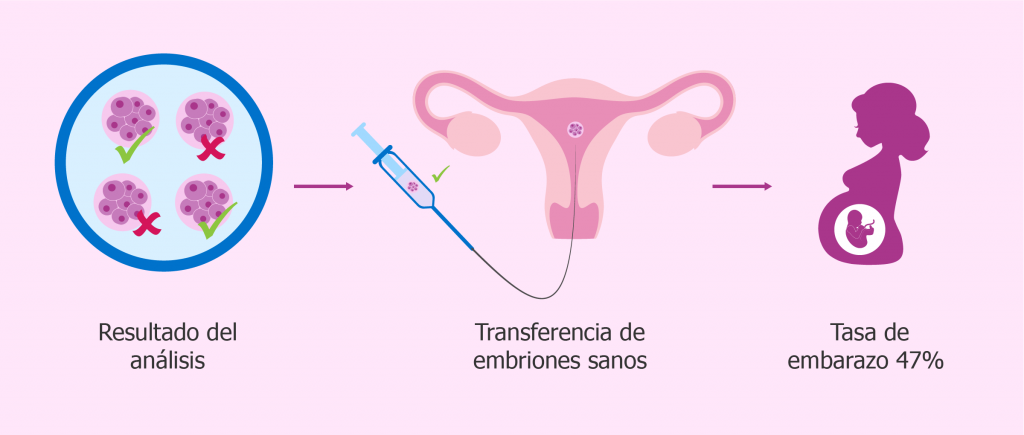 Diagnóstico genético preimplantacional - Doctores Povedano